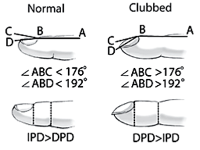 Approach to the Respiratory Patient: Differential Diagnoses of Common ...
